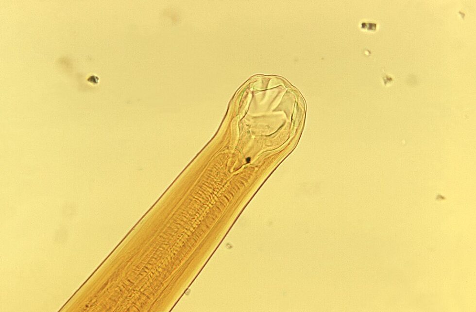 How Parasites Could Be The Key To Treating Multiple Sclerosis » Survive ...